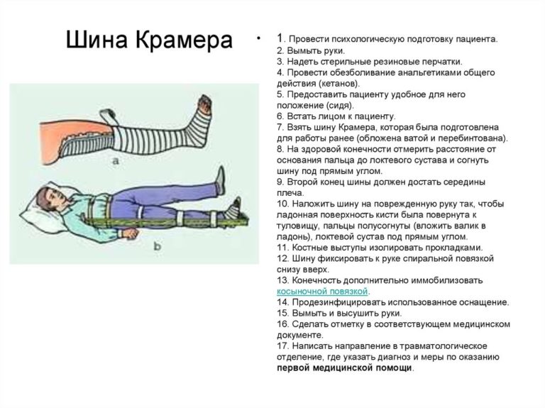 Иммобилизация при переломе бедра: какие суставы, когда и зачем подлежат ...