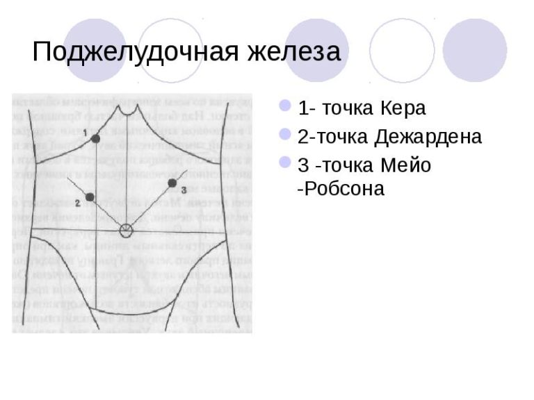 Симптом Мерфи: техника выполнения и точность диагностики